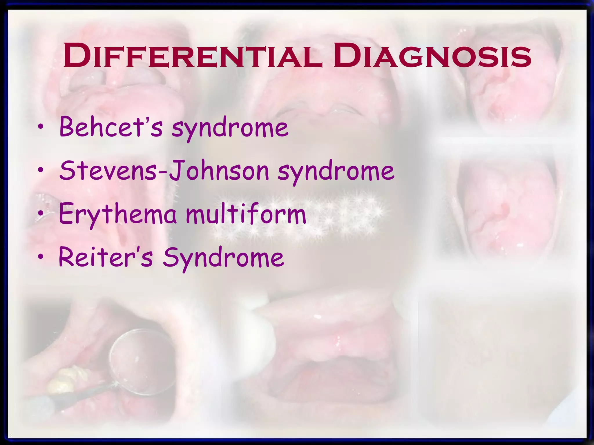 Oral medicine case behcet disease | PPT