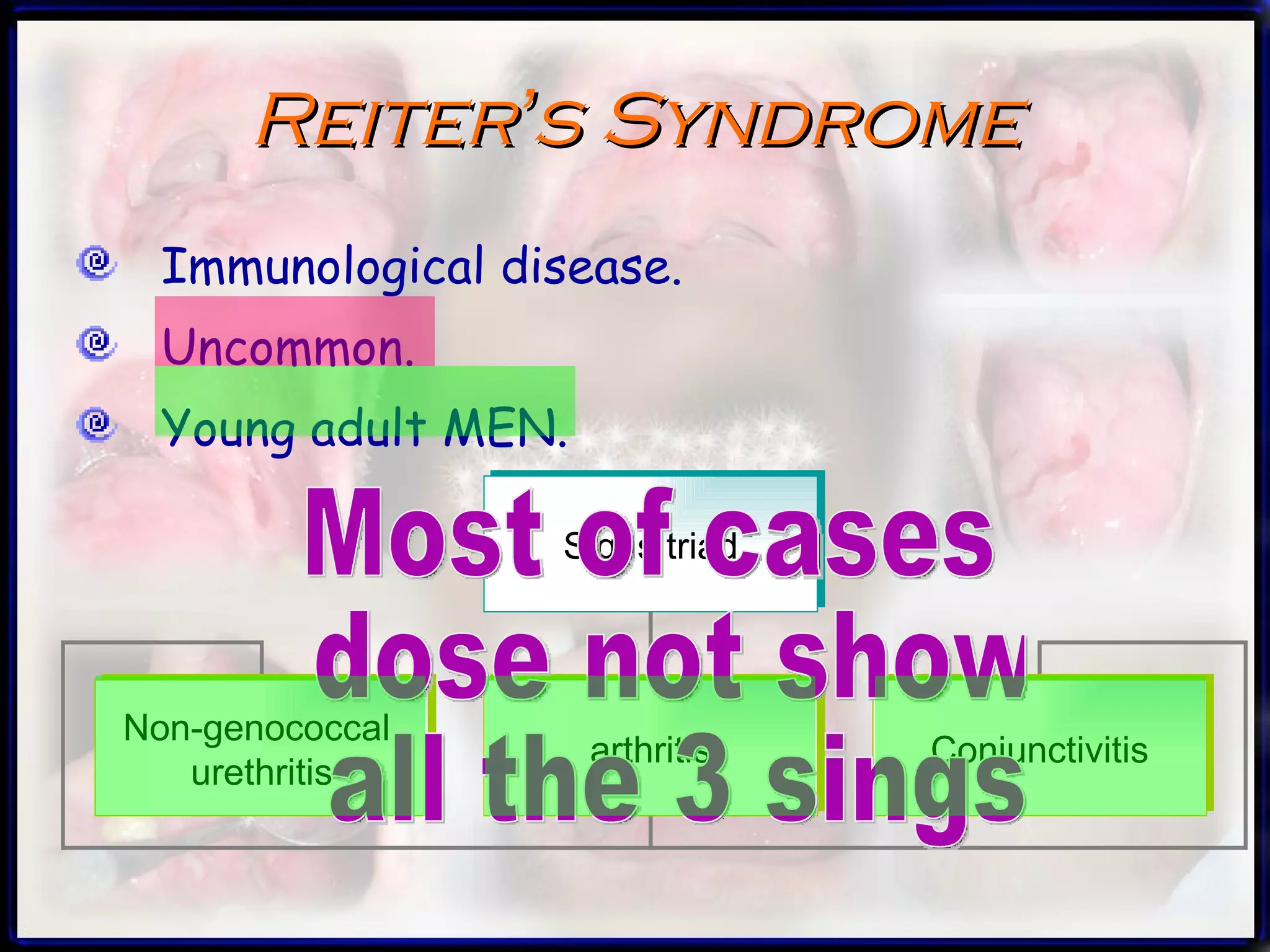 Oral medicine case behcet disease | PPT