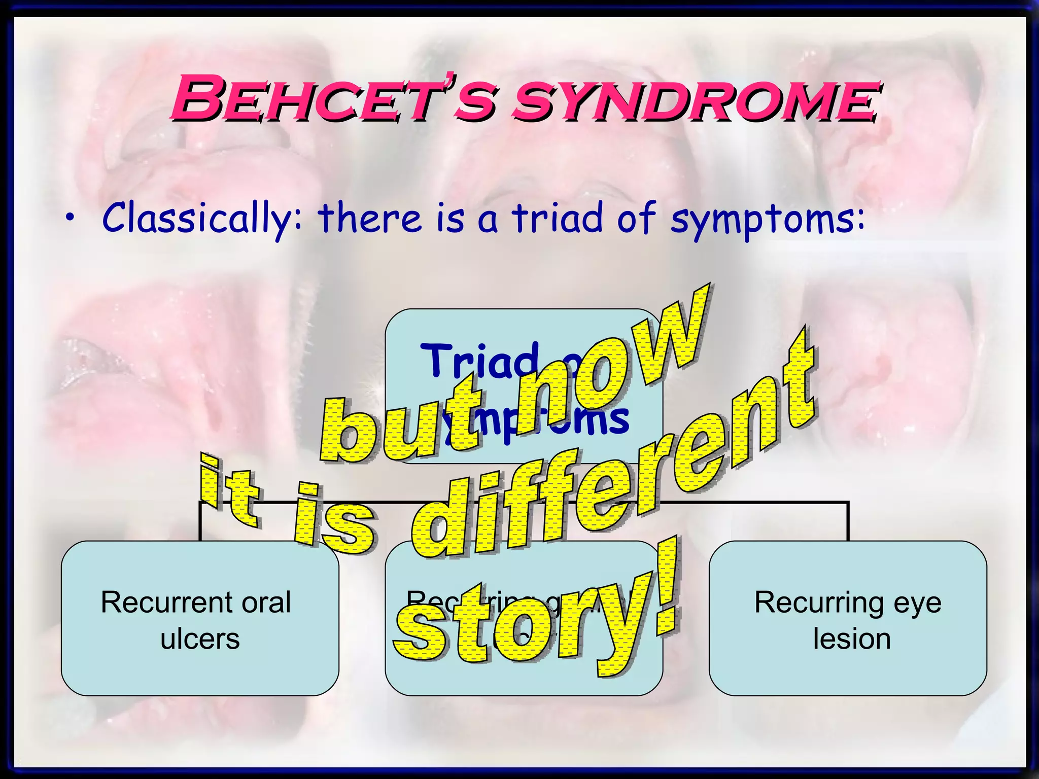 Oral medicine case behcet disease | PPT