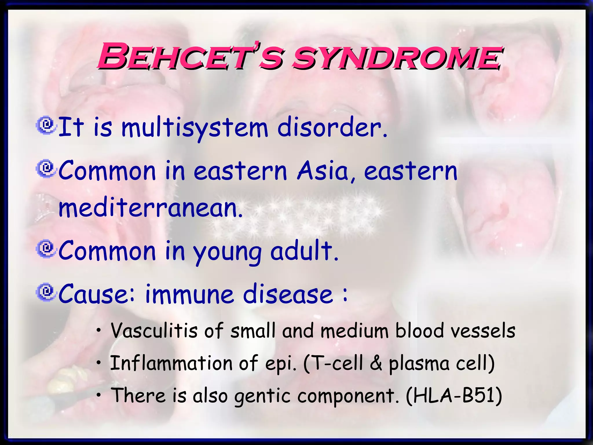 Oral medicine case behcet disease | PPT