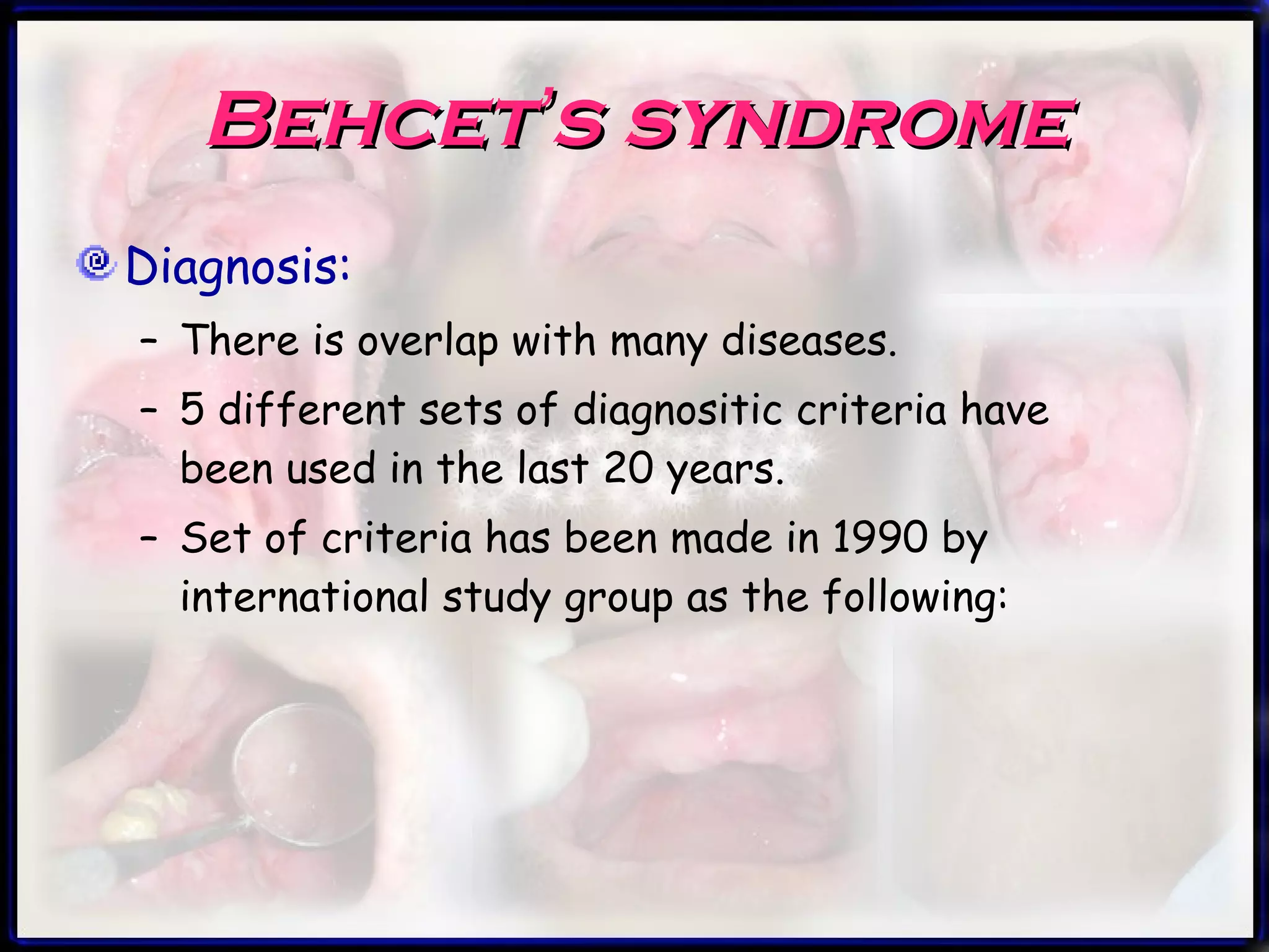 Oral medicine case behcet disease | PPT