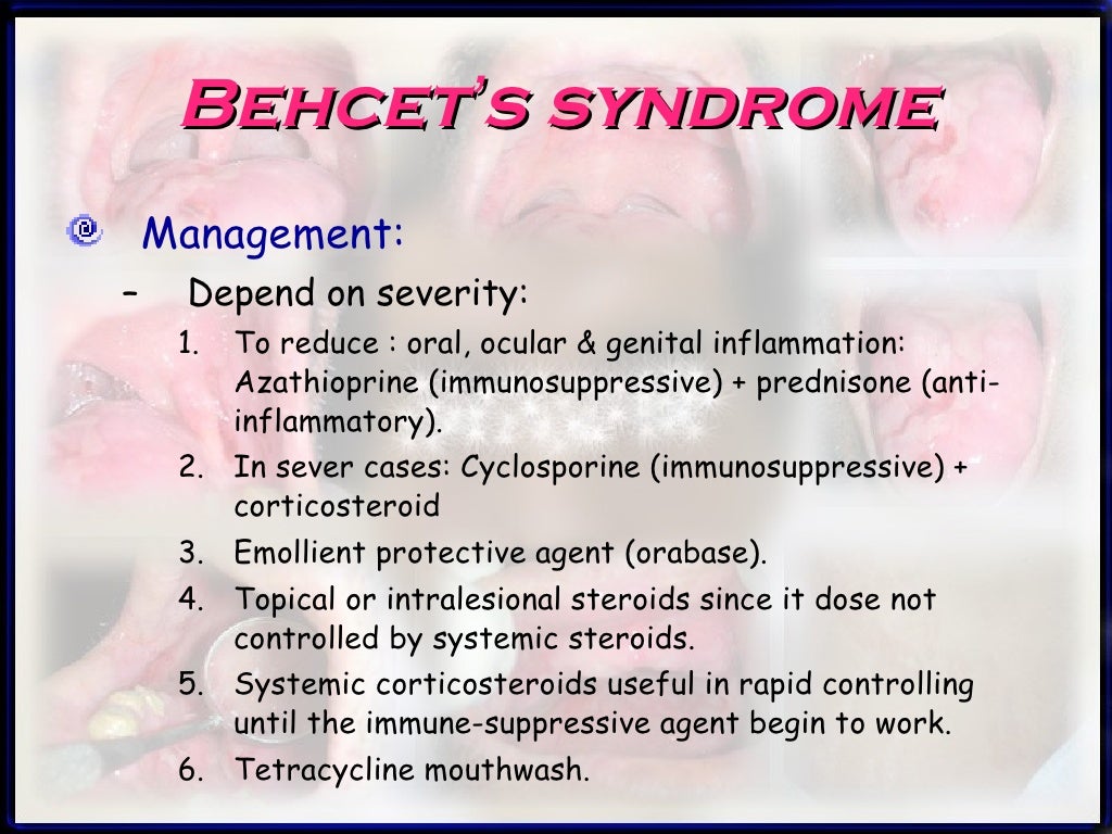 Oral medicine case behcet disease