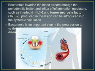 Relation Between Periodontal Diseases and Kidney Diseases | PPTX