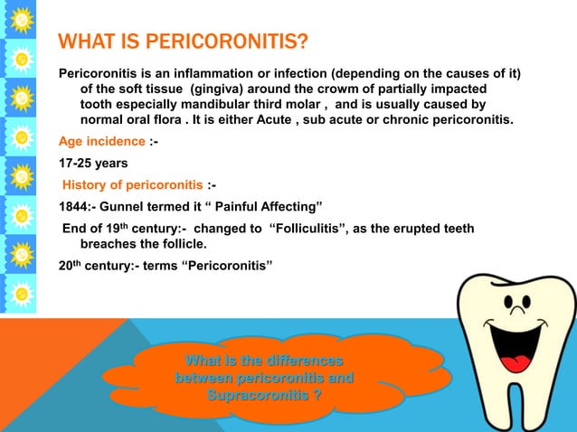 pericoronitis(RR) | PPTX