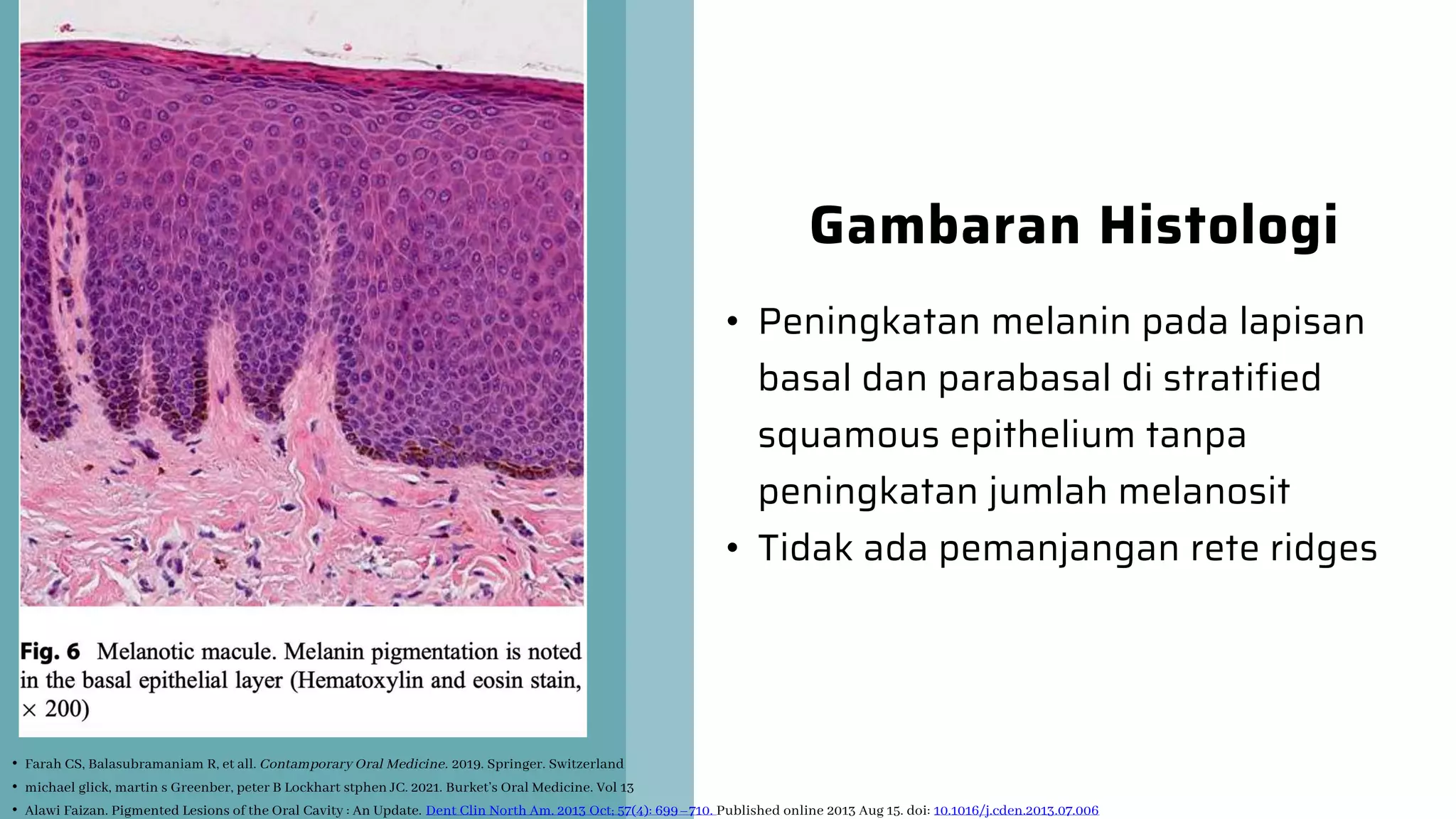 Oral Melanotic Macule-3.pptx