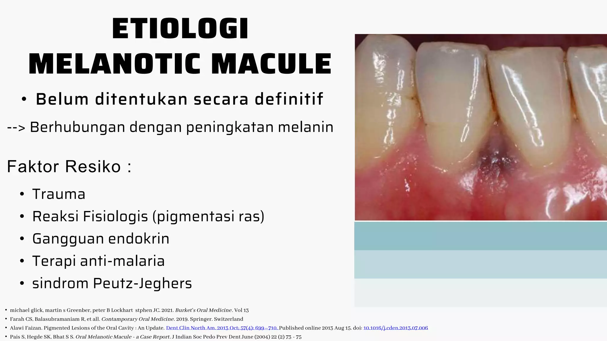Oral Melanotic Macule-3.pptx