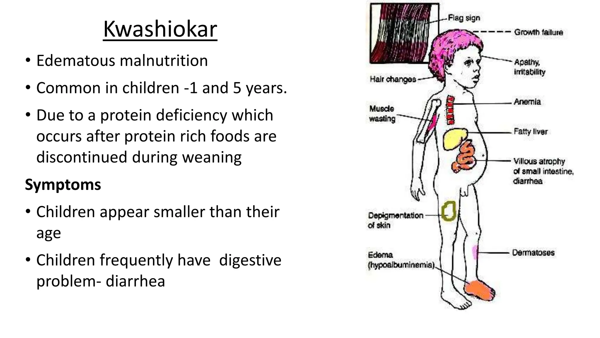 ORAL METABOLIC DISORDER-Metabolism is a complex (Physio-chemical ...