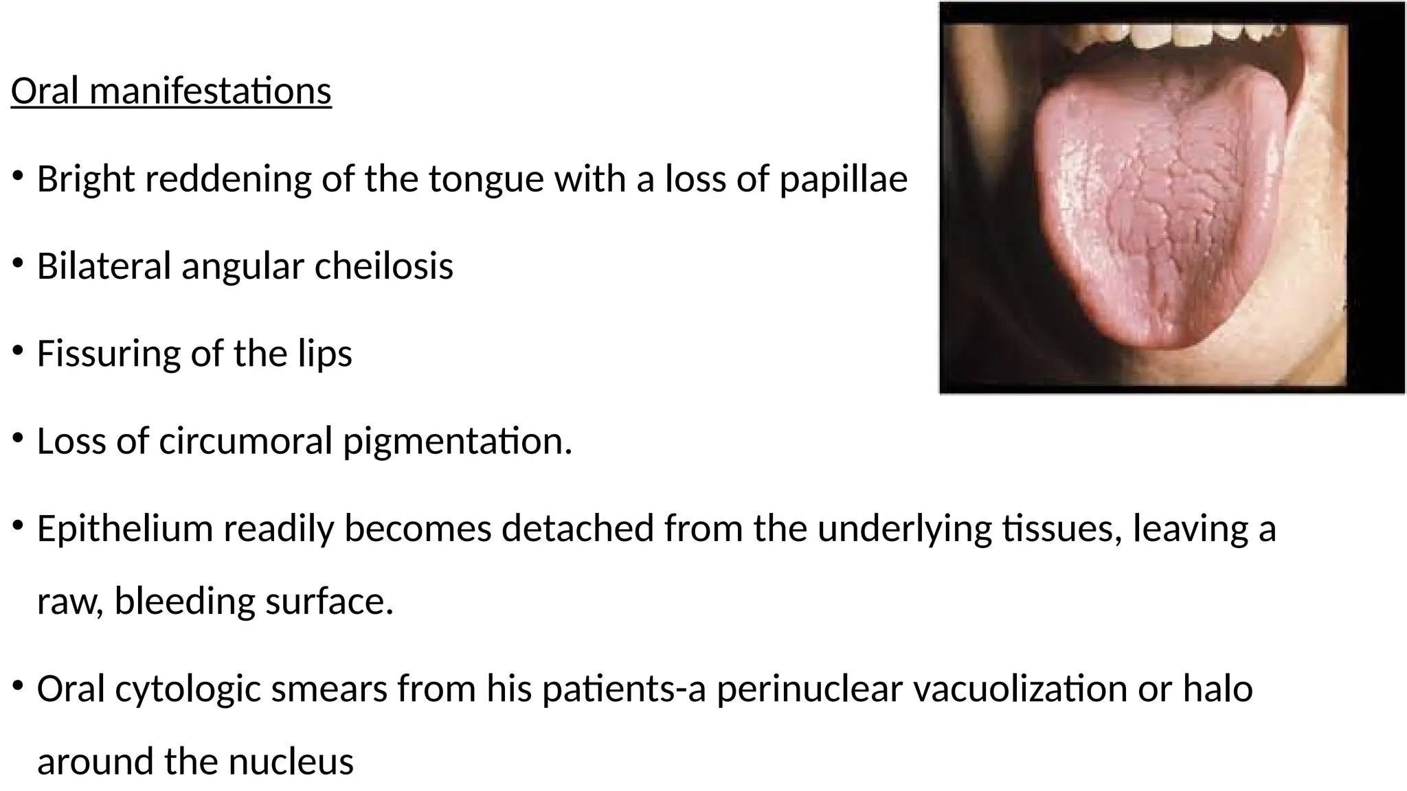 ORAL METABOLIC disorders of body; pptx. 1 | PPTX