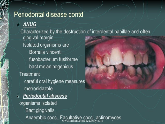 Oral microbial flora /certified fixed orthodontic courses by Indian d…