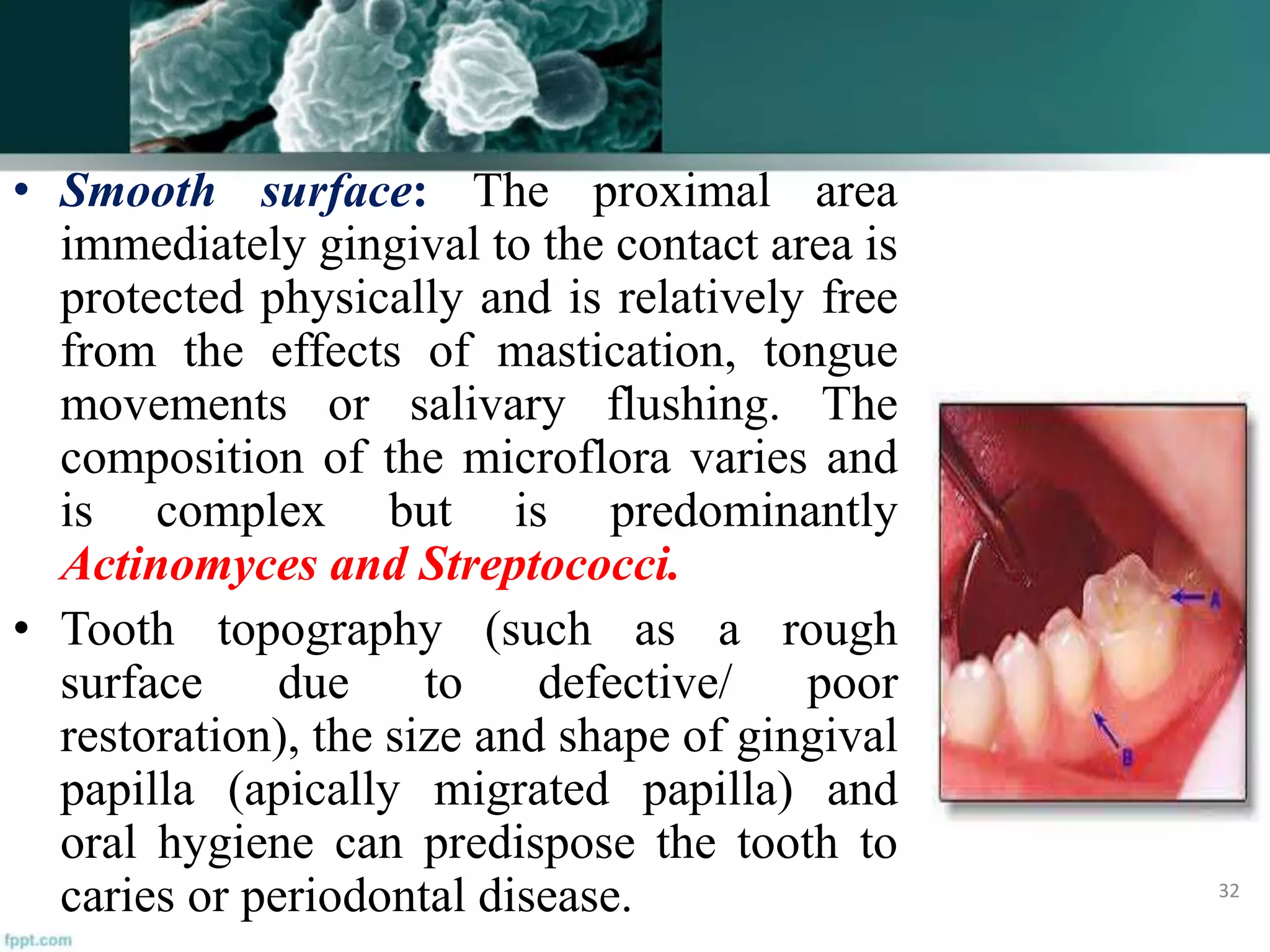 Oral microflora | PPTX