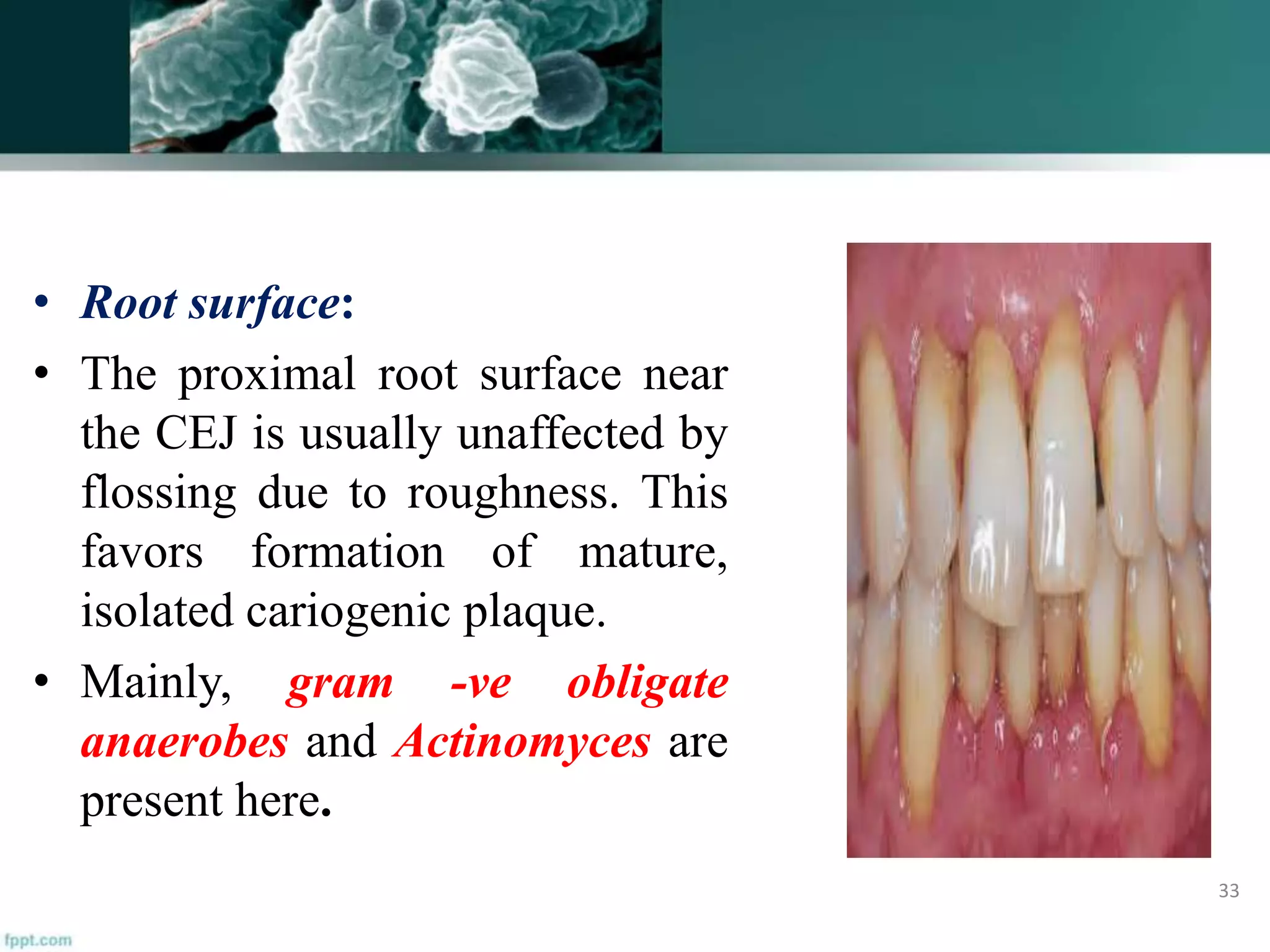 Oral microflora | PPTX
