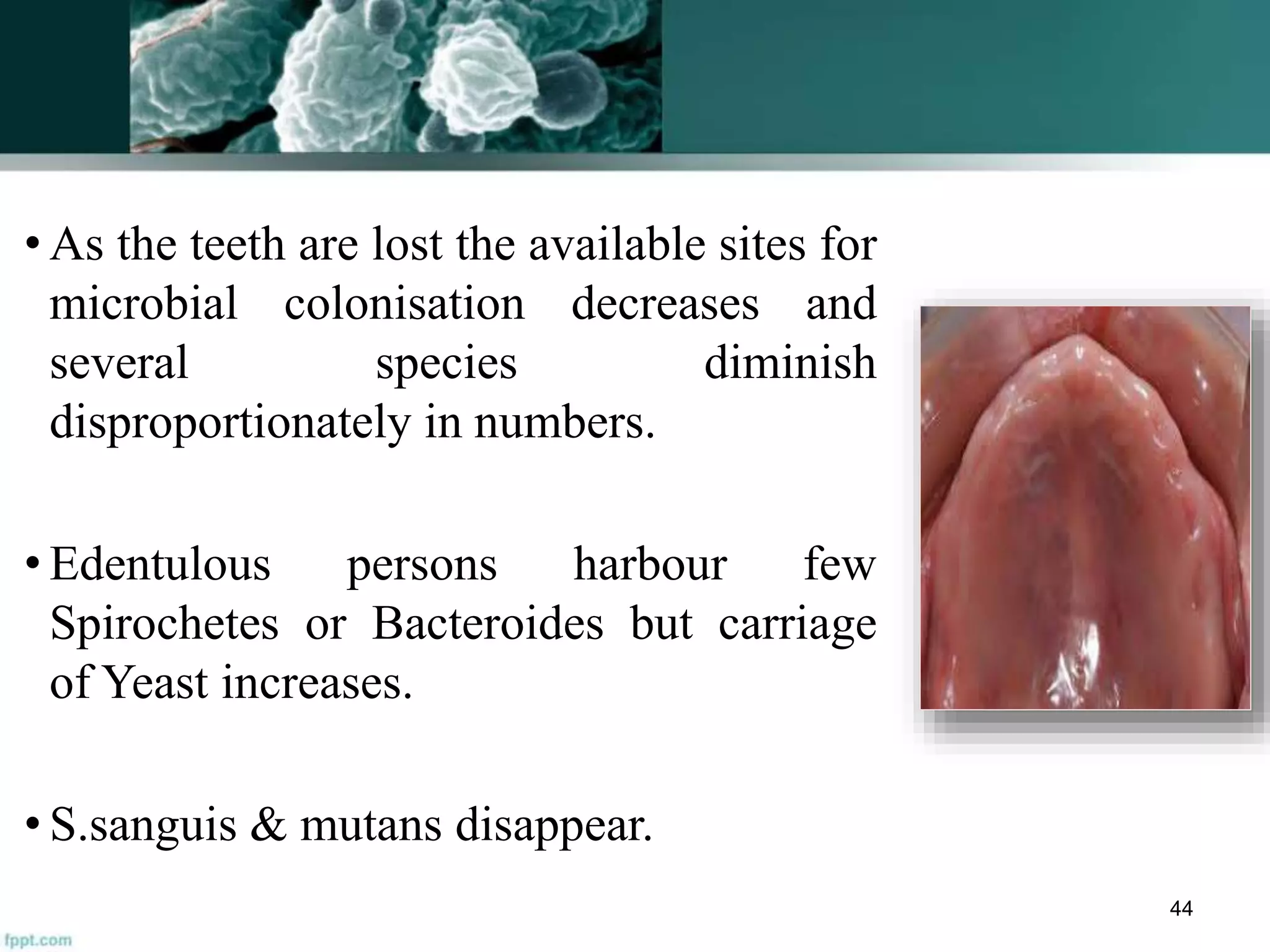Oral microflora | PPTX
