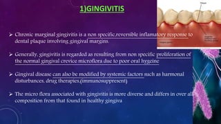 Oral microbiology:normal oram microflora and Dental plaque | PPTX