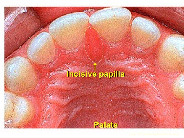 Oral mucosa/ dental implant courses