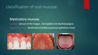 Oral mucosa1234 | PPTX