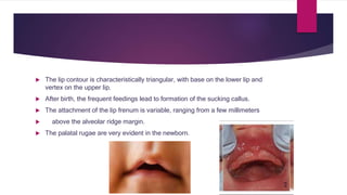 Strecture of oral mucosa in children.pptx