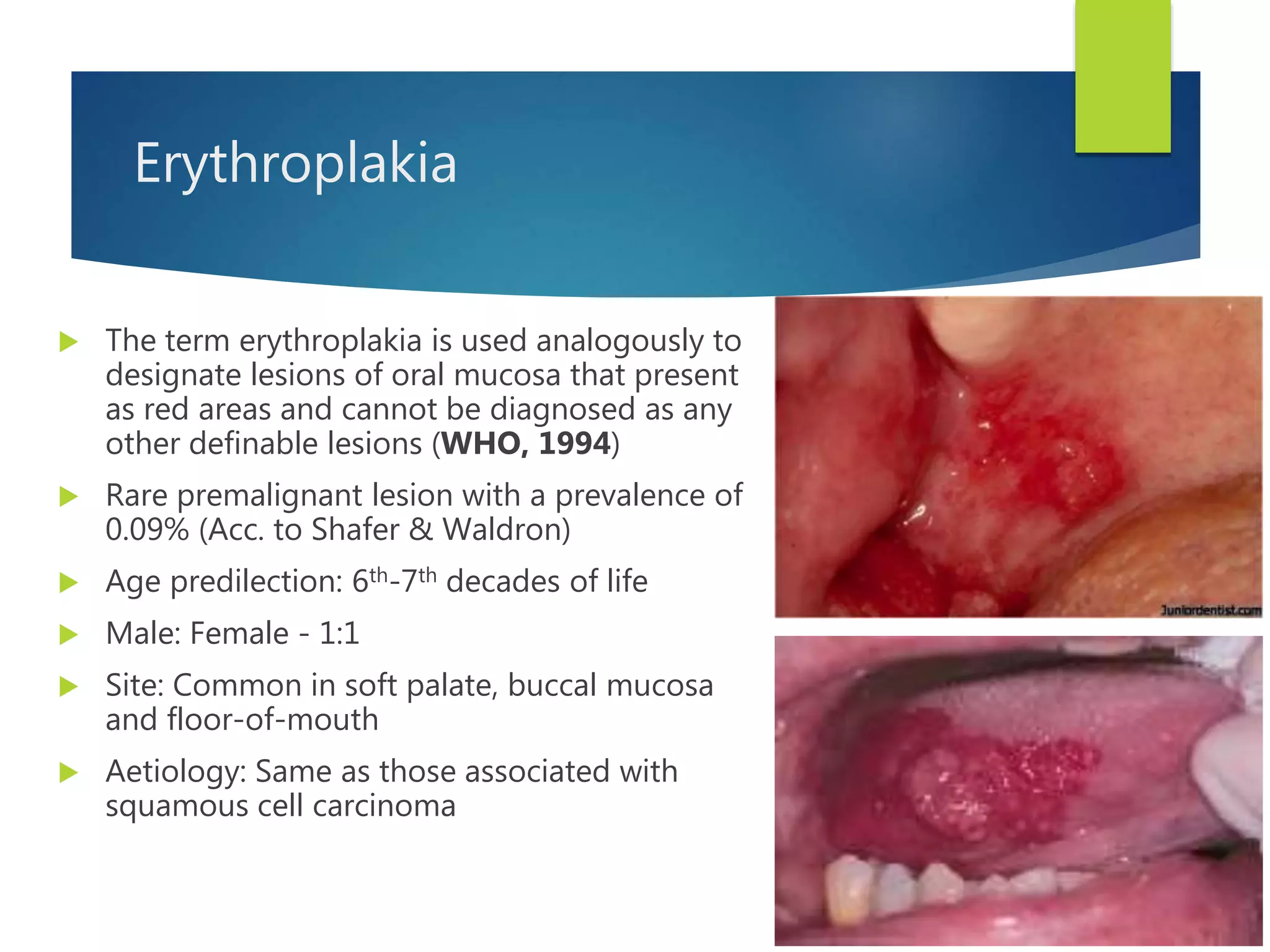 Oral mucosal lesions | PPTX