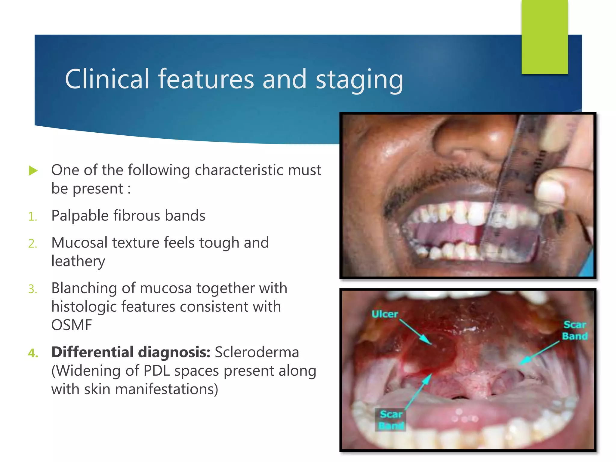 Oral mucosal lesions | PPTX