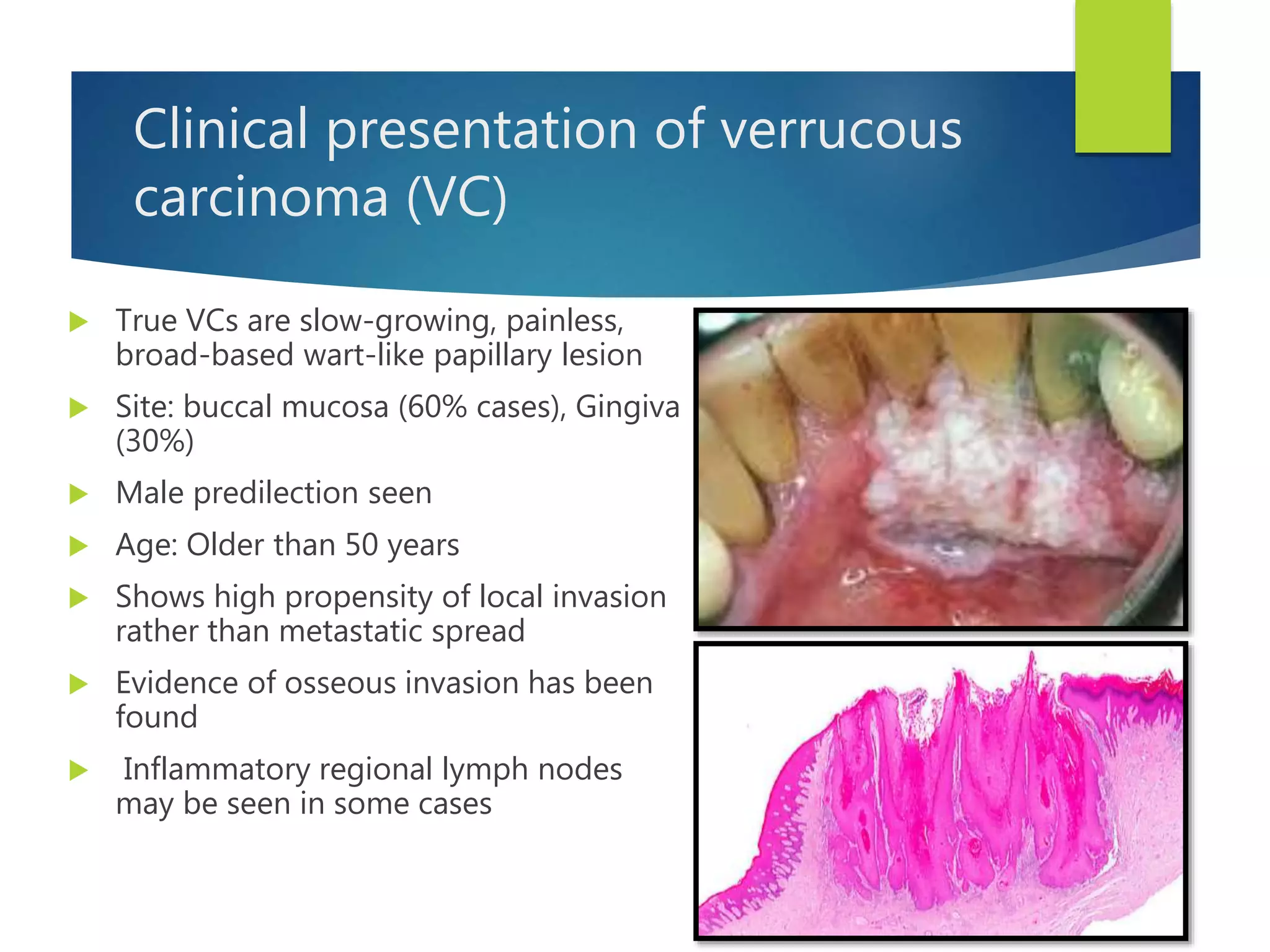 Oral mucosal lesions | PPTX