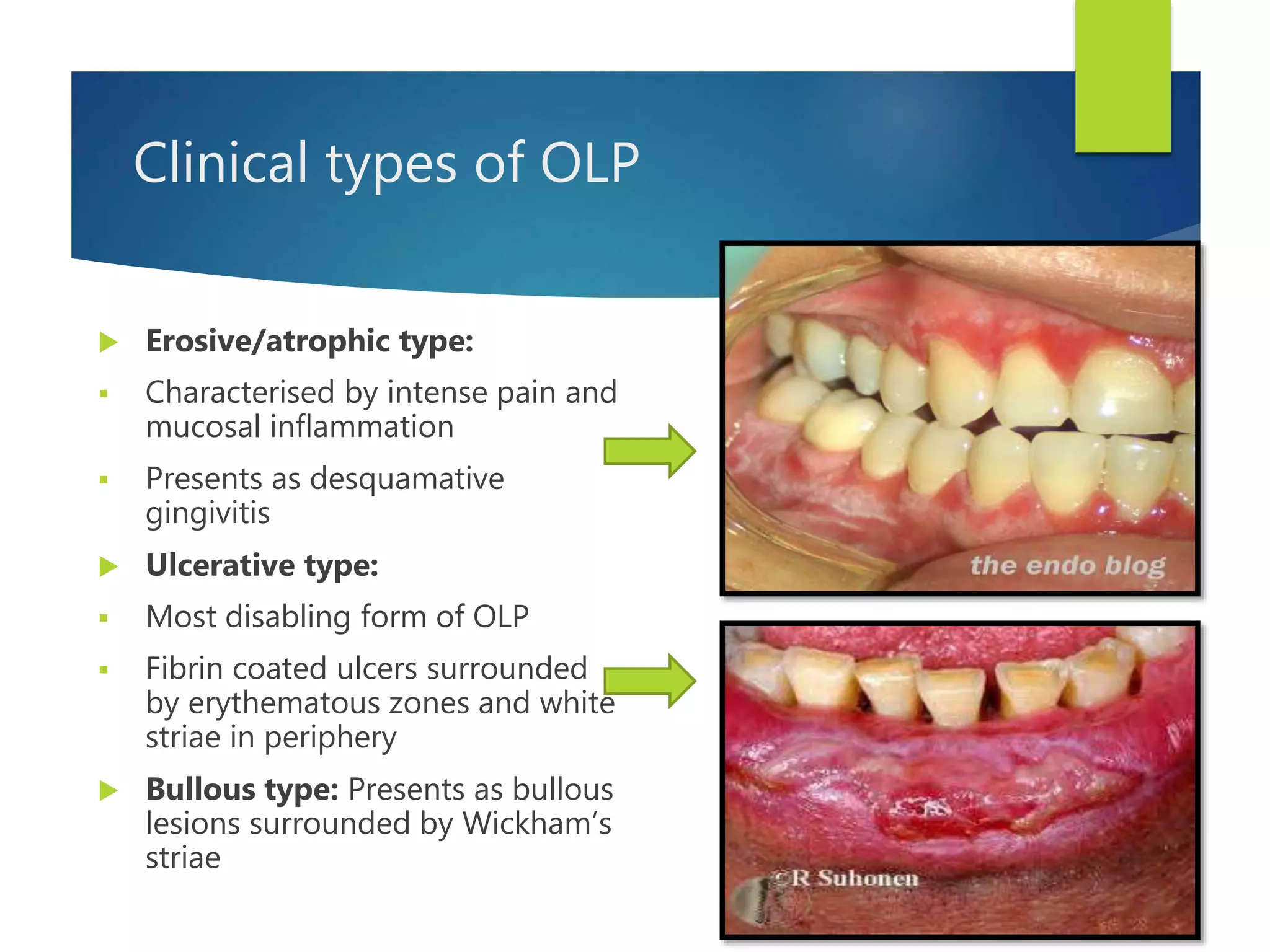 Oral mucosal lesions | PPTX
