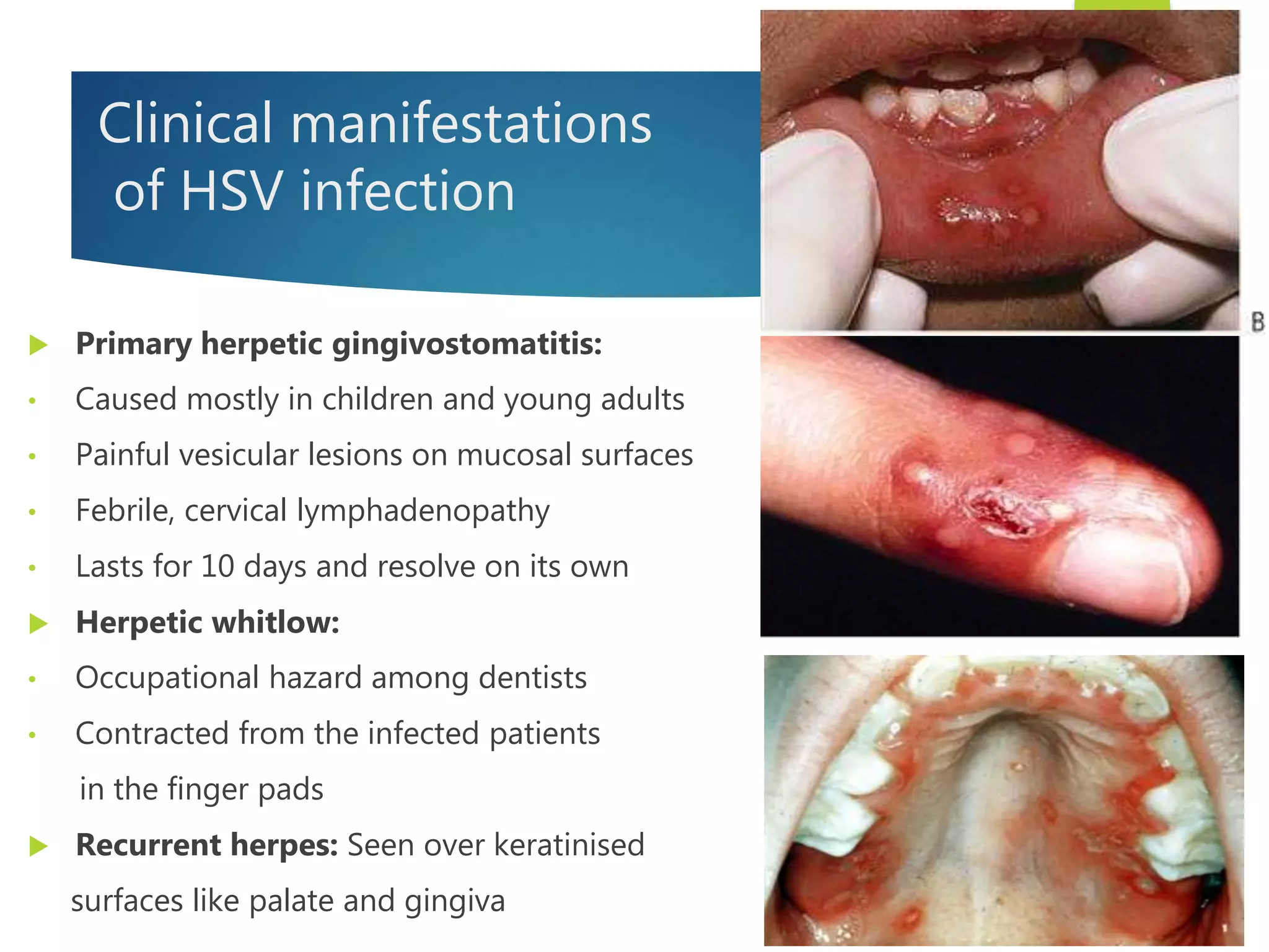 Oral mucosal lesions | PPTX