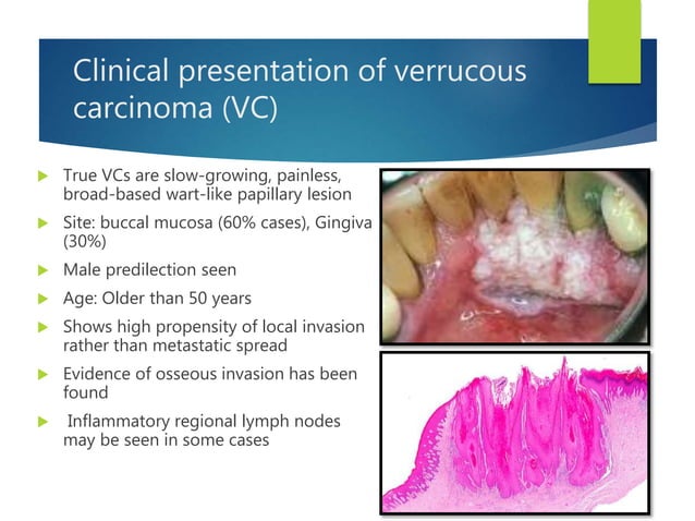 Oral mucosal lesions | PPTX | Skin and Dermatology | Diseases and ...