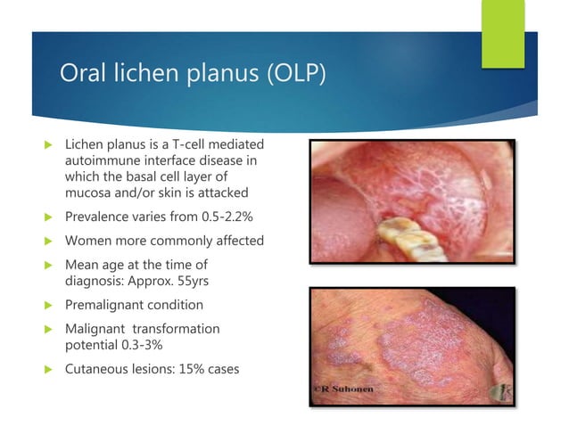 Oral mucosal lesions | PPTX | Skin and Dermatology | Diseases and ...