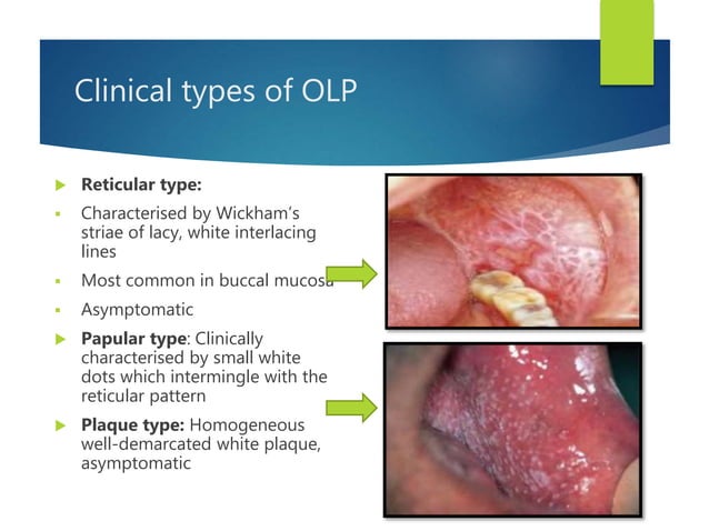 Oral mucosal lesions | PPTX | Skin and Dermatology | Diseases and ...