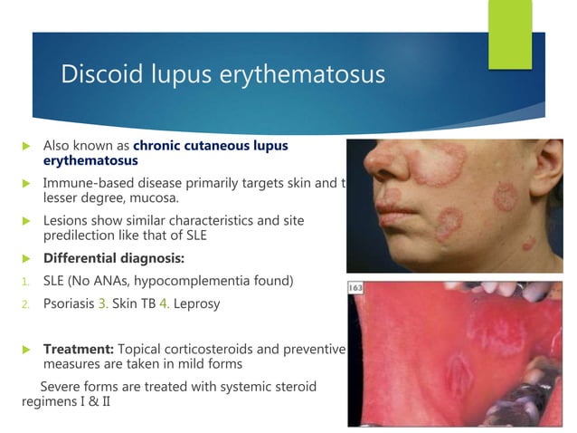Oral mucosal lesions | PPTX | Skin and Dermatology | Diseases and ...