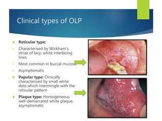 Types Of Oral Diseases