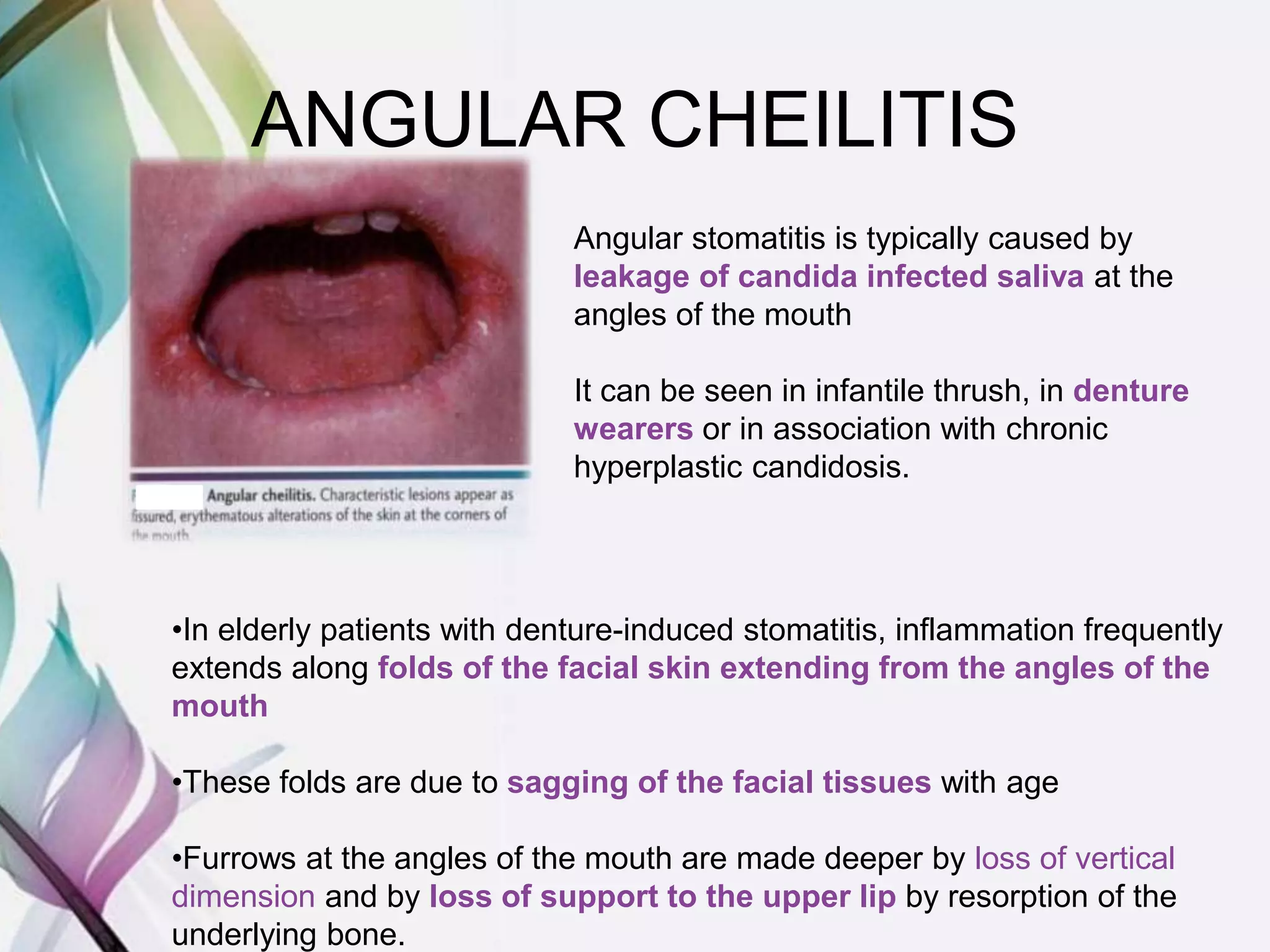 Oral mucosal lesions in denture wearers | PPTX