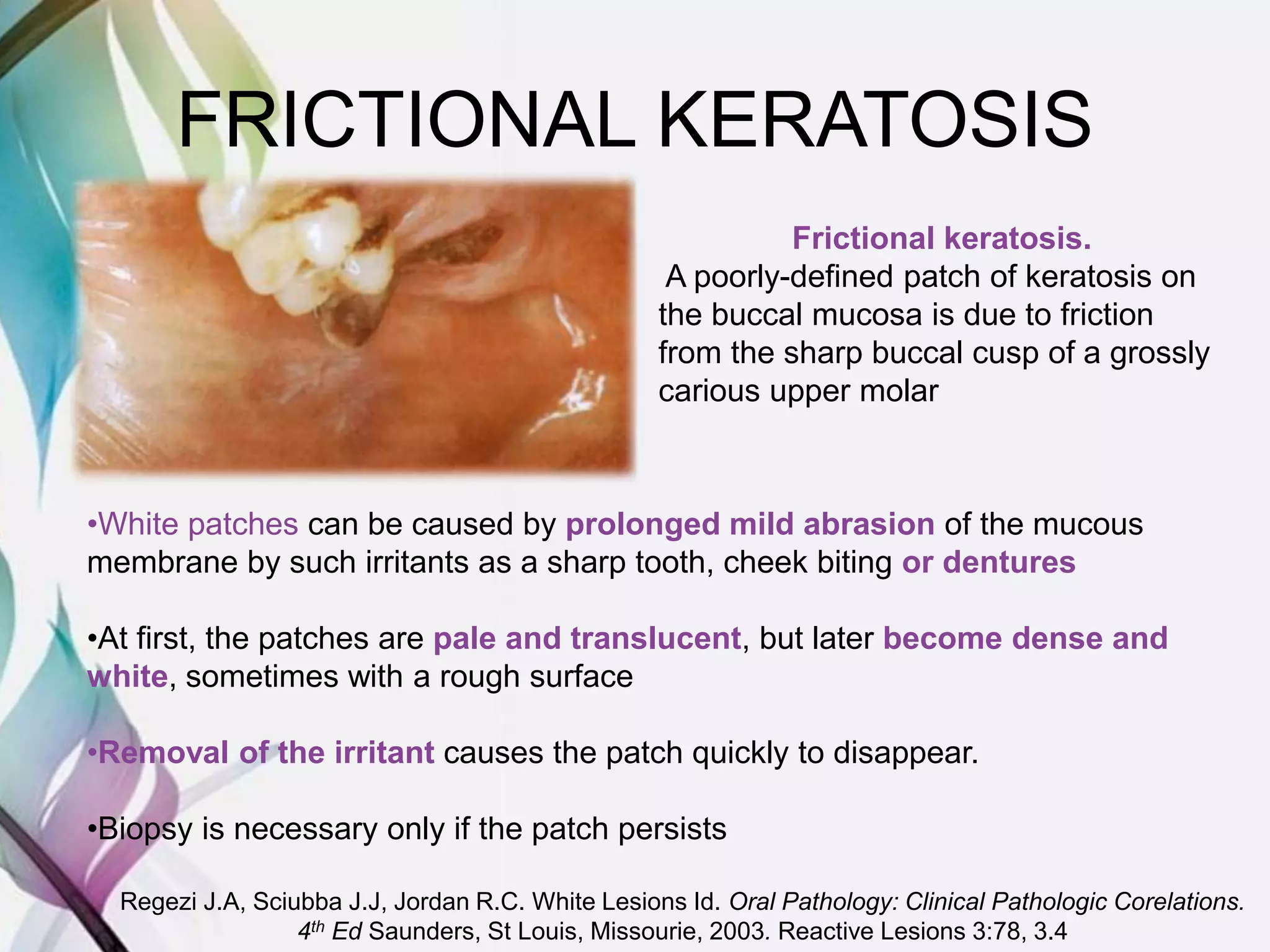 Oral mucosal lesions in denture wearers | PPTX