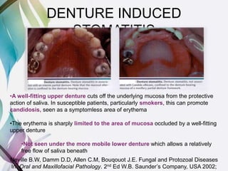 Oral mucosal lesions in denture wearers | PPTX