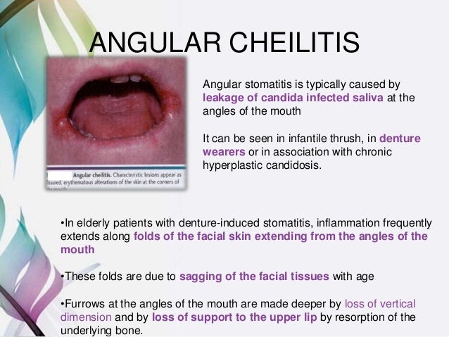 Oral mucosal lesions in denture wearers