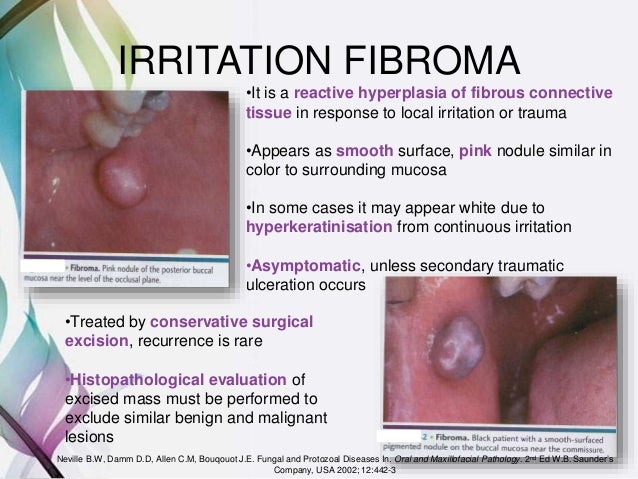 Oral mucosal lesions in denture wearers