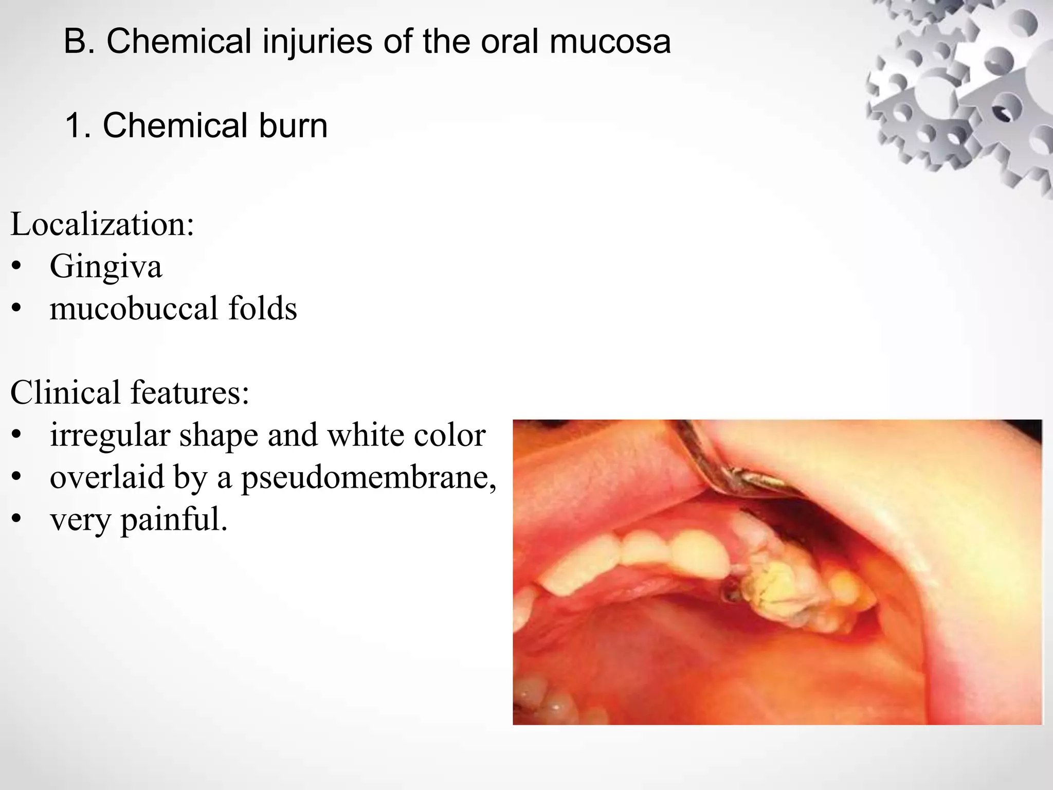 Oral mucosal trauma and injuries.pptx