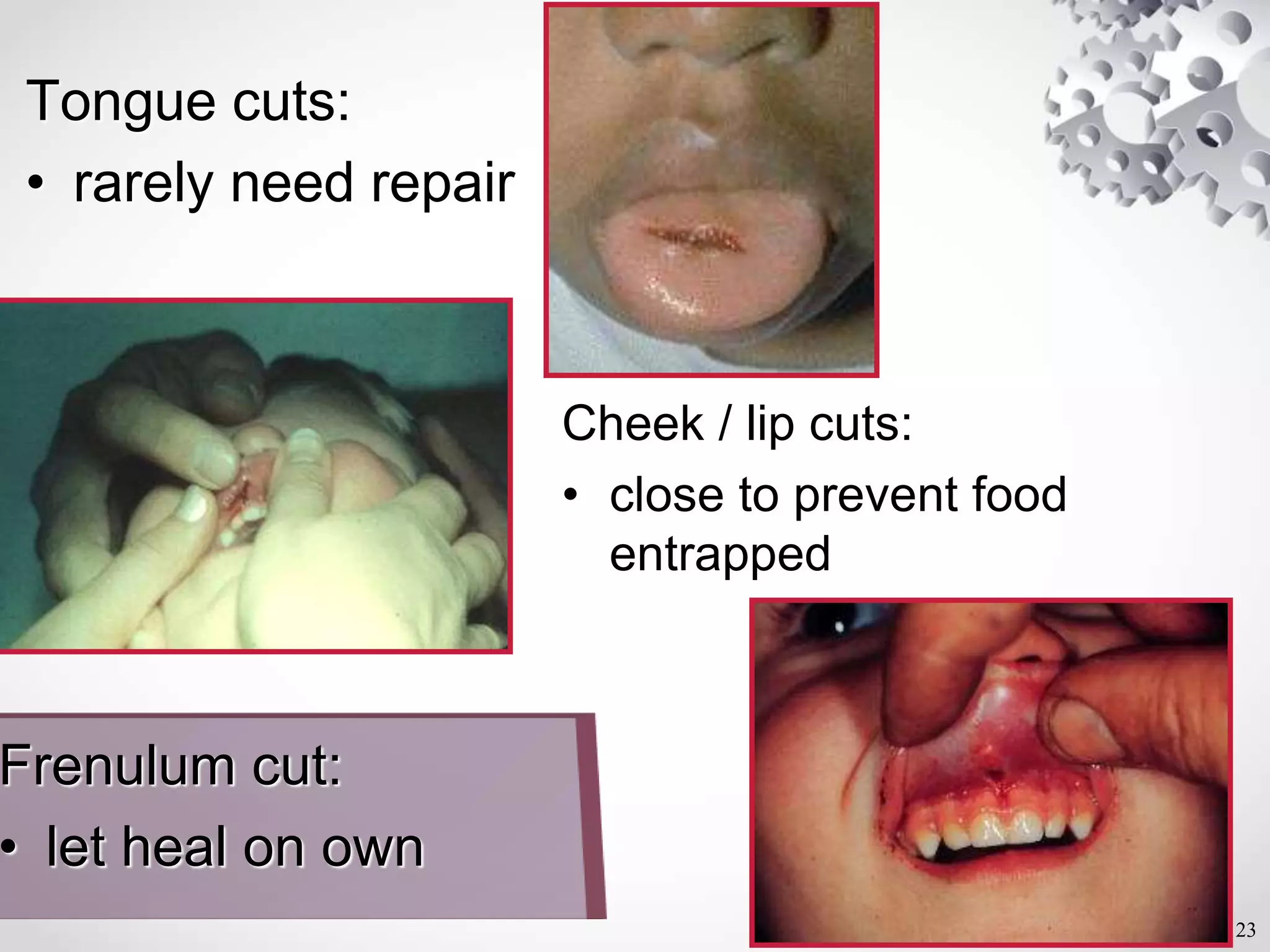 Oral mucosal trauma and injuries.pptx