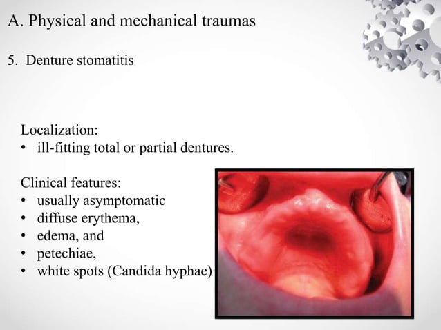 Oral mucosal trauma and injuries.pptx