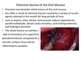 Oral mucosal ulceration | PPTX