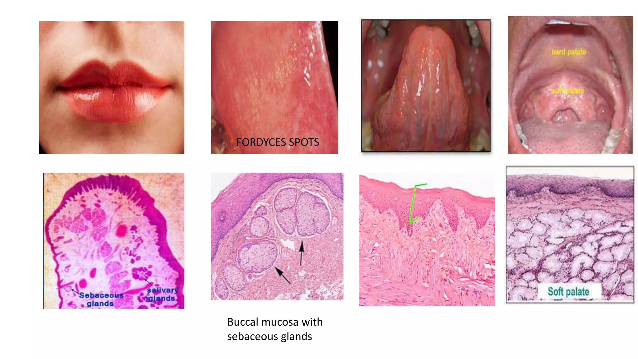 Oral mucosa part 2 | PPTX