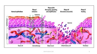 ORAL MUCOSITIS easy ppt for Nurses | PDF