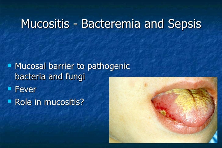 Oral Mucositis In Cancer Care