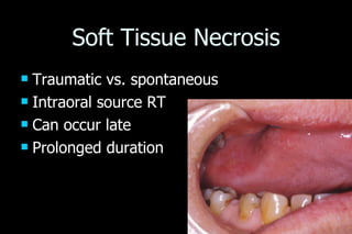 Oral Mucositis In Cancer Care Is The End In Sight | PPT