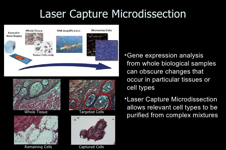 Oral Mucositis In Cancer Care Is The End In Sight