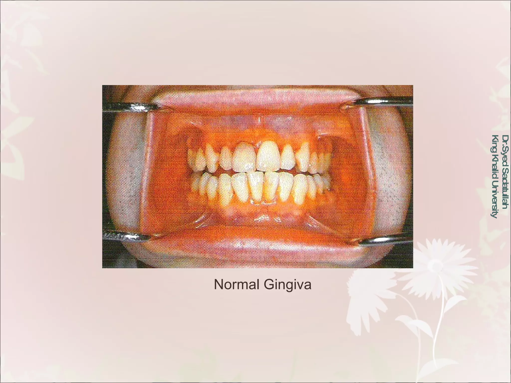Oral Mucous Membrane | PPT