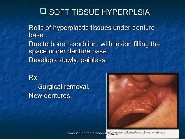 Oral mucous membrane/ oral surgery courses