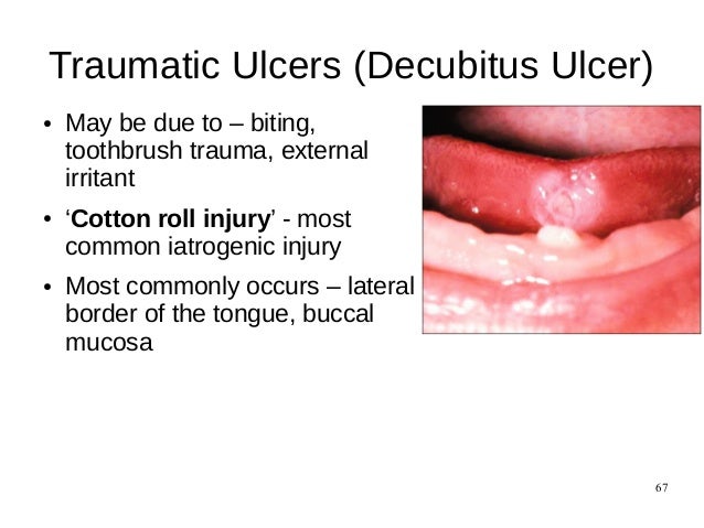 Oral Mucous Membrane