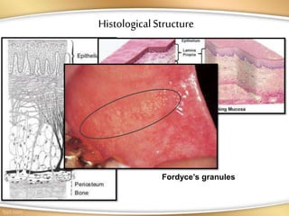 Oral mucous membrane | PPT