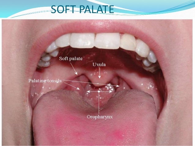 Oral mucous membrane pictorial representation