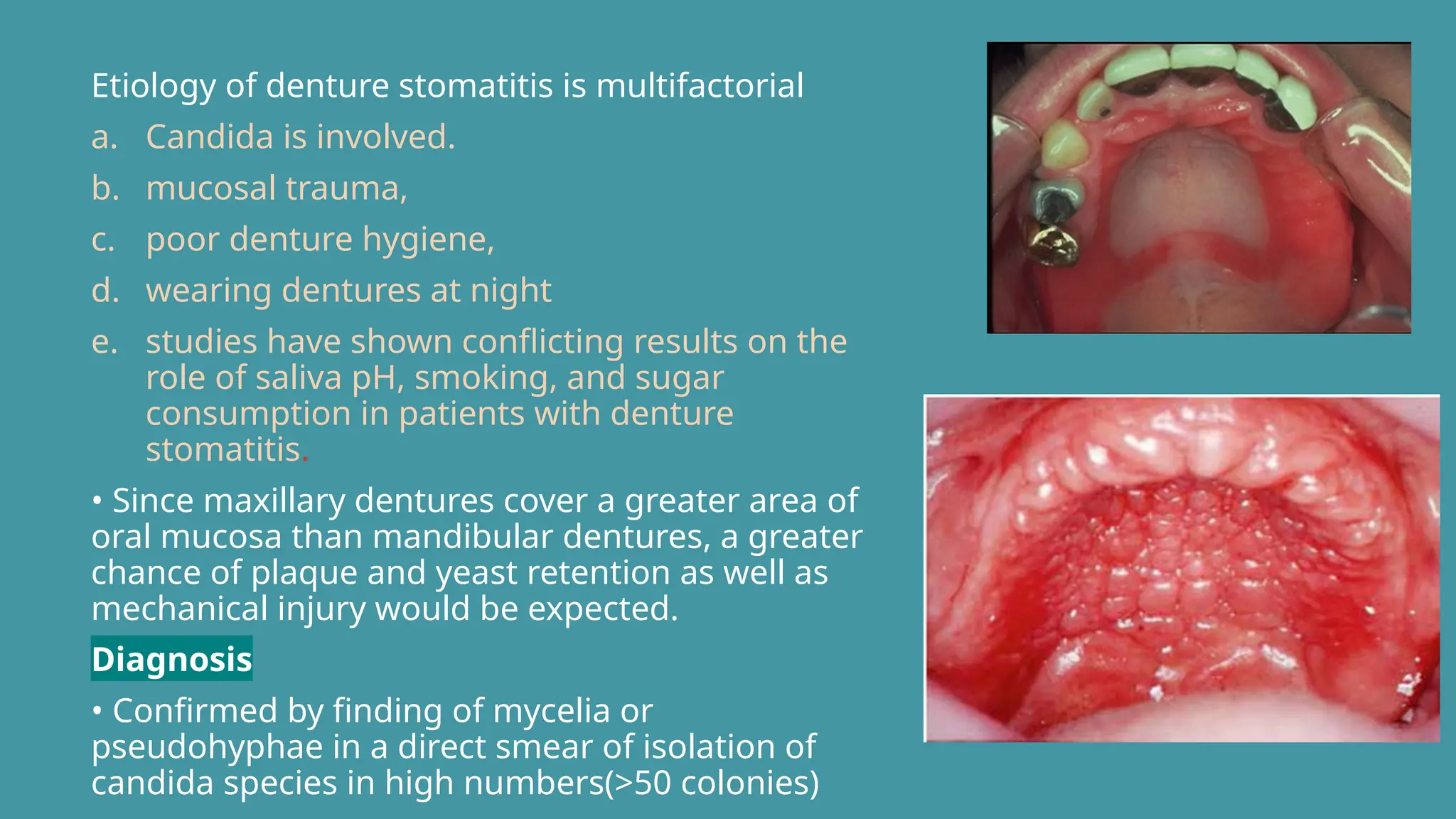 oral mucous membrane manjusha mam ppt.pptx